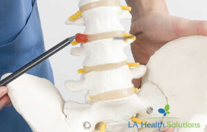 What Is A Discogram? | LA Health Solutions Treatments