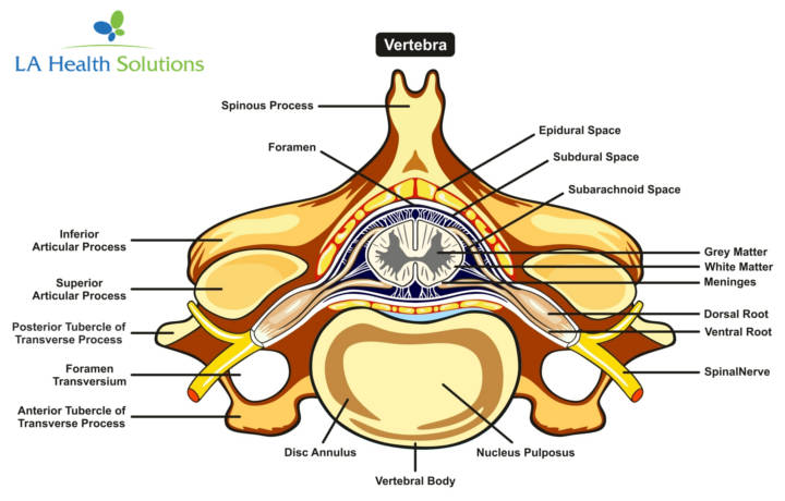 What Is A Discogram? | LA Health Solutions Treatments