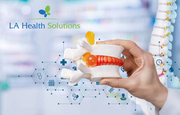 Artificial Cervical Disc Replacement (Mobi-C®) | LA Health Solutions of ...